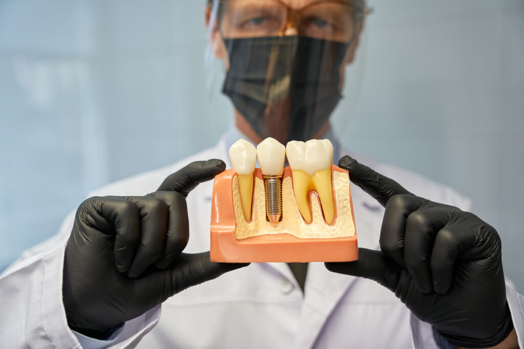 Boosting Bone Density for Stronger Dental Implants